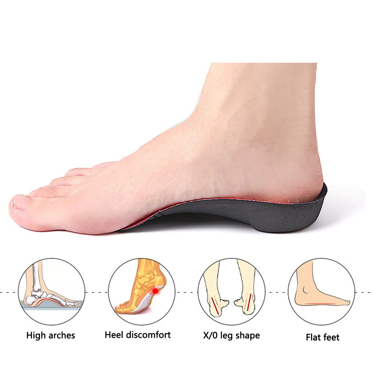 Types Of Foot Arches
