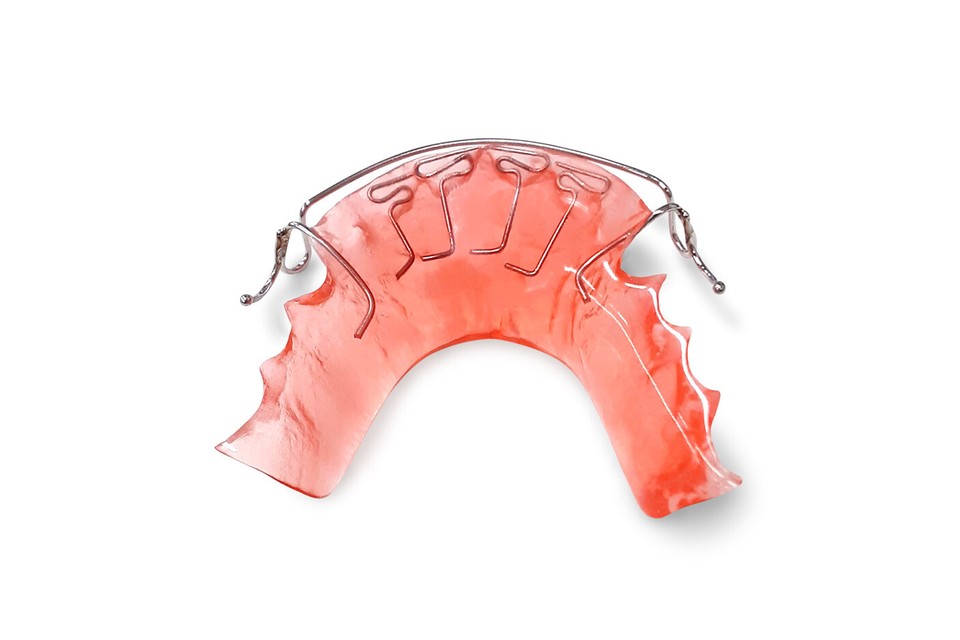 Custom Hawley Spring Retainer, Removable, At-Home Dental | eBay