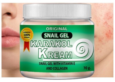 2 units KARAKOL KREAM, snail cream gel acne dark spot skincare spots ...