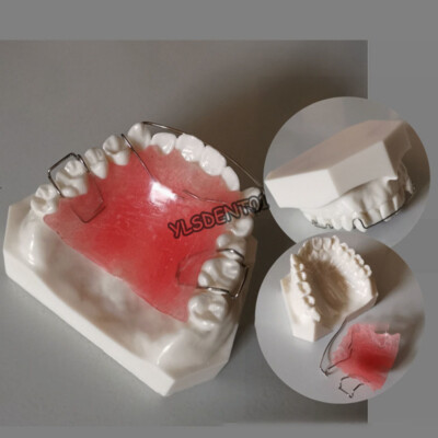 Dental Orthodontic Teeth Model With Hawley Retainer Study Teach Demo ...