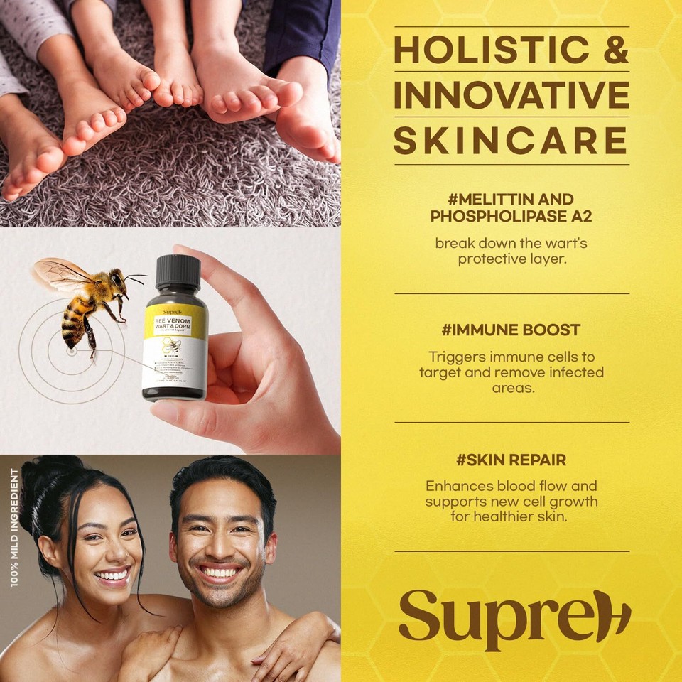 SupreH Fast-Acting bee Venom wart Remover wart Freeze Off with ...