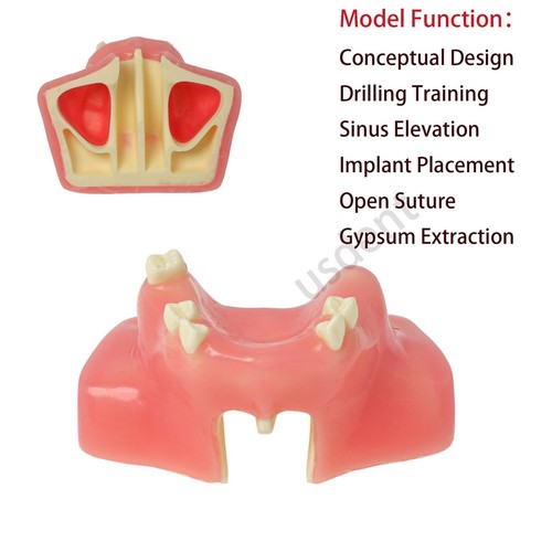Dental Implant Insertion Maxillary Sinus Floor Lifting Practice ...