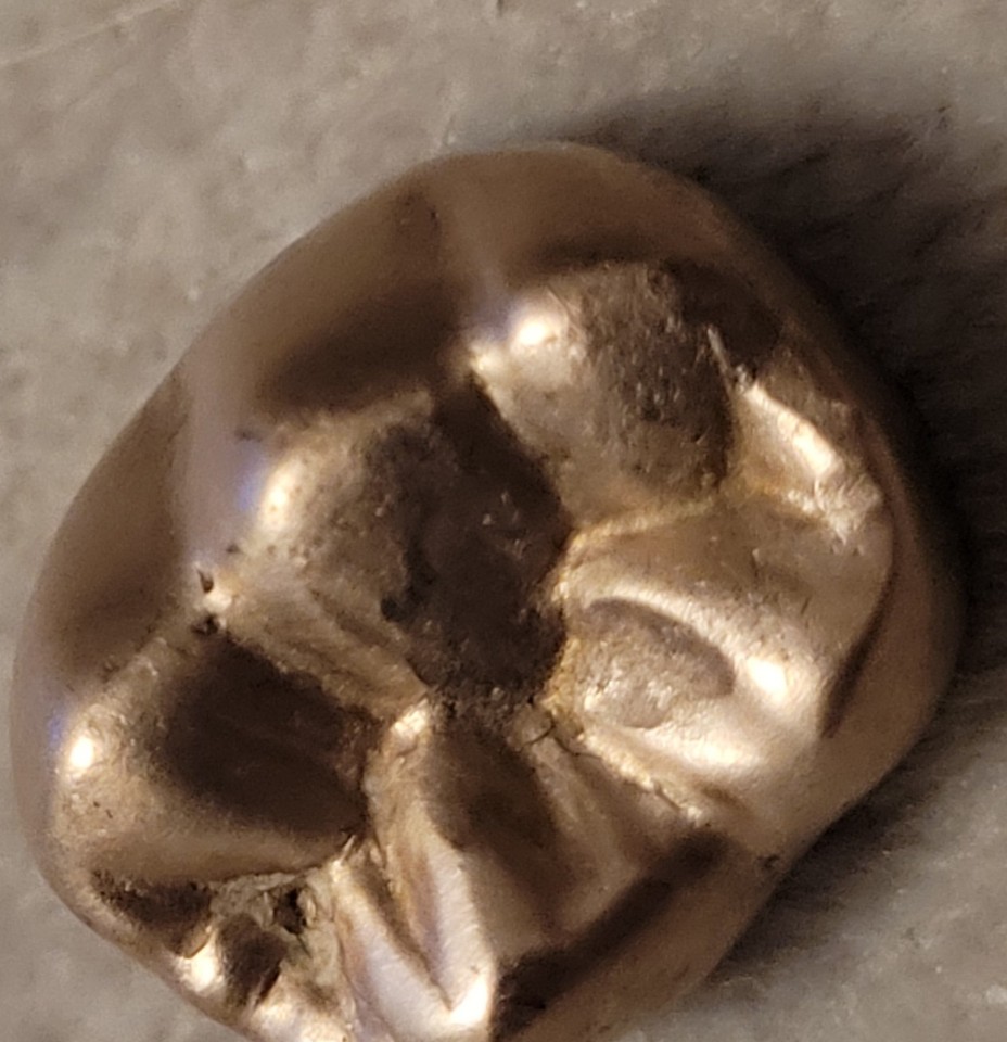 3.36g Grams Scrap Gold Dental Tooth Cap 10k or 16k from 1996. | eBay UK