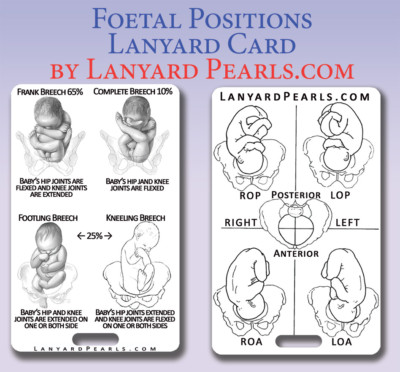 Fetal Positions Lanyard Card | Midwife Nursing Student Obstetrics | eBay.de