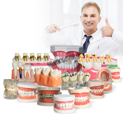 Dental Typodont Teeth Model Ortho Implant Pathological Perio Practice ...