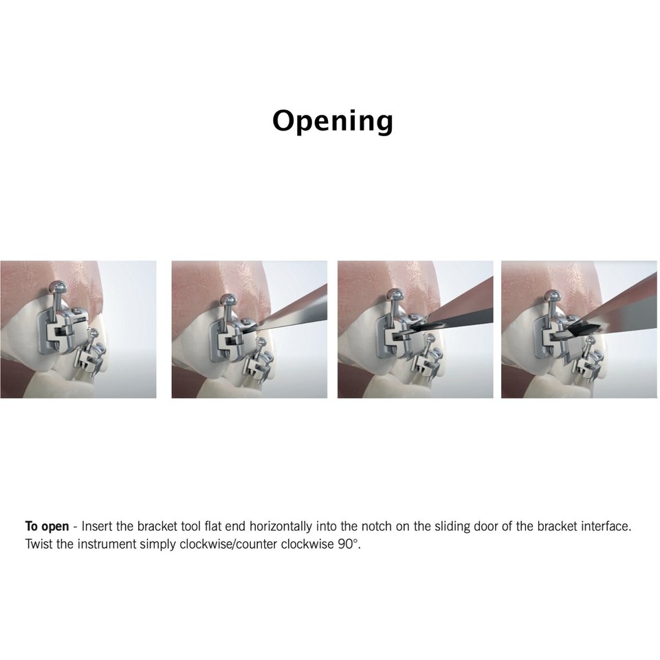 Dental Orthodontic Brackets Self Ligating Braces Metal Ceramic Roth MBT ...
