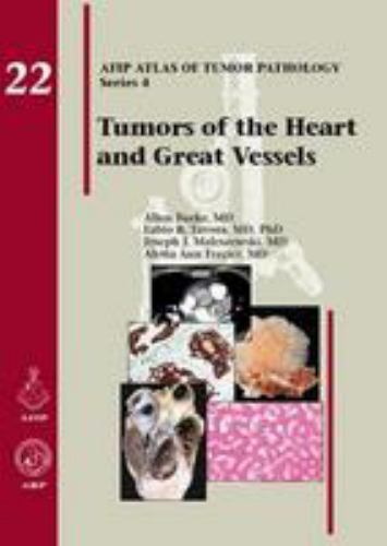 AFIP Atlas of Tumor Pathology, Series 4, Ser.: Tumors of the Heart and ...
