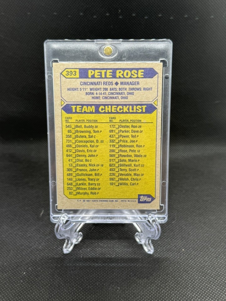 1987 Topps - #393 Pete Rose Manager Double Error Card | eBay