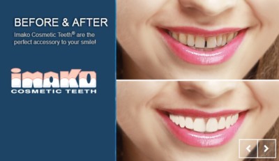 Original Imako Cosmetic Teeth Instant Smile Veneer. FREE NEXT DAY ...