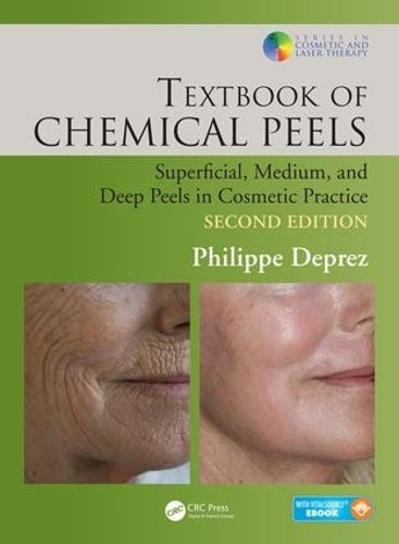 Philippe Deprez Textbook of Chemical Peels (Relié) 9781482223934 | eBay