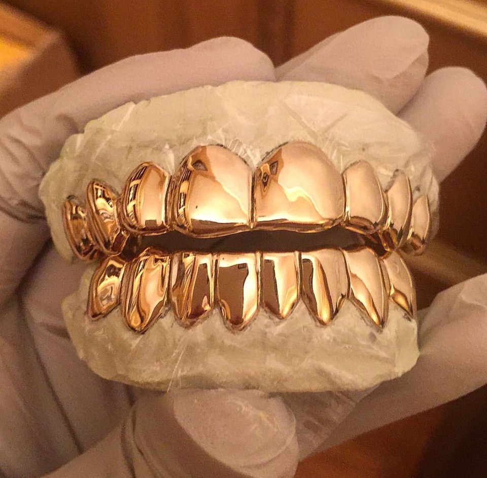 MA CUSTOM 8/8 22k REAL SOLID GOLD PERM CUT GRILLZ | eBay
