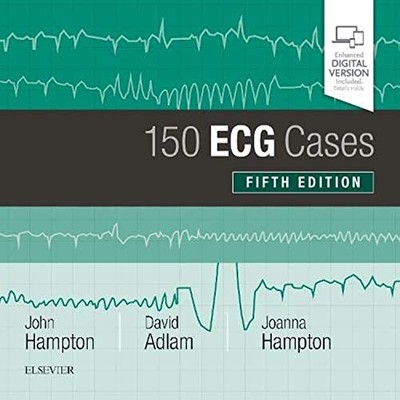 150 ECG Cases, 5e, Paperback by Hampton MD MA BM BCh FR Paperback ...