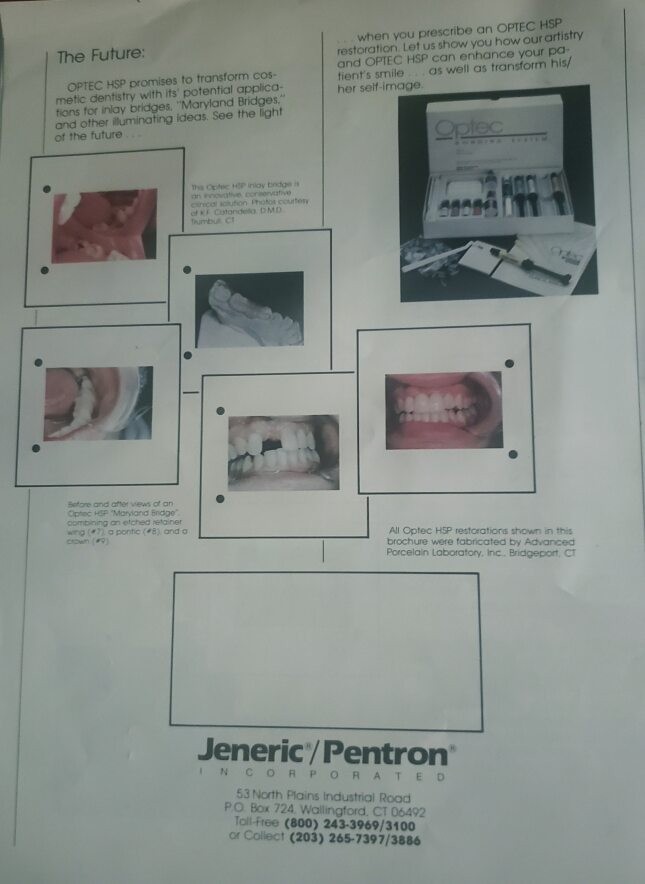 Optec HSP Dental Porcelain, for all Ceramic metal free Crowns. New | eBay