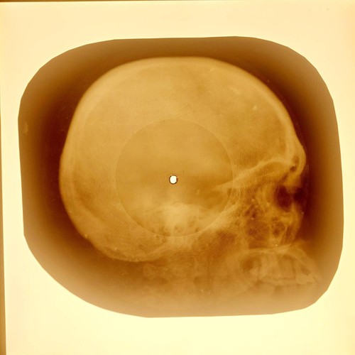 USSR X-RAY SKULL ROENTGEN BONES RECORD ORIGINAL OLD RIBS 563 | eBay