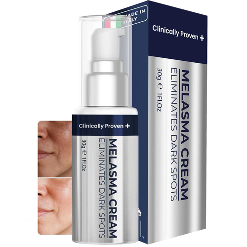 Dark Spot Remover for Face Body Melasma Cream Age Spot Remover for Skin ...