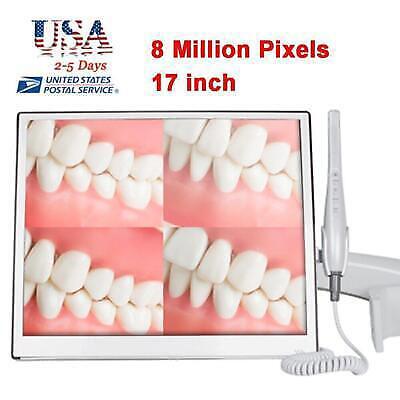 17 Inch Dental Intra Oral Camera WIFI High-Definition Digital AIO ...