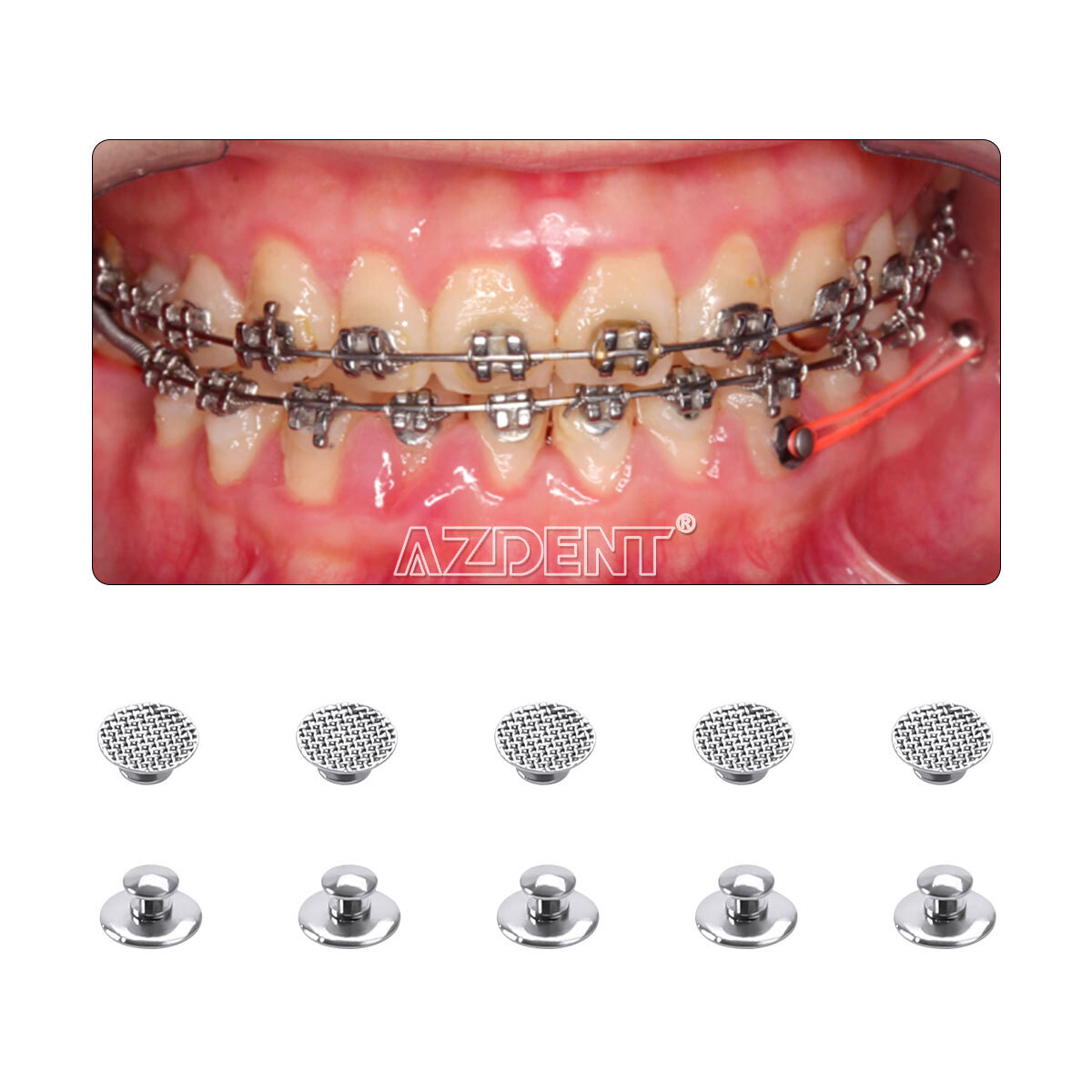 Azdent Orthodontic 10 X AZDENT Dental Orthodontic Monoblock Bracket
