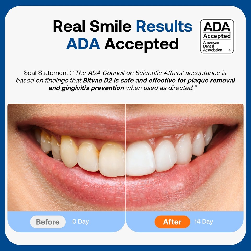 ADA Accepted Electric Toothbrush, Travel Toothbrush Rechargeable for ...