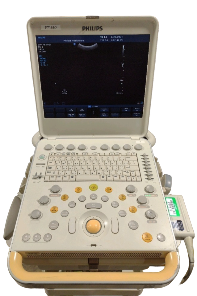 Philips CX50 Portable Ultrasound Machine with C5-1 Abdominal Probe ...