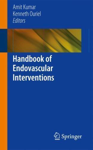 Handbook of Endovascular Interventions by Kenneth Ouriel (2012, Trade ...