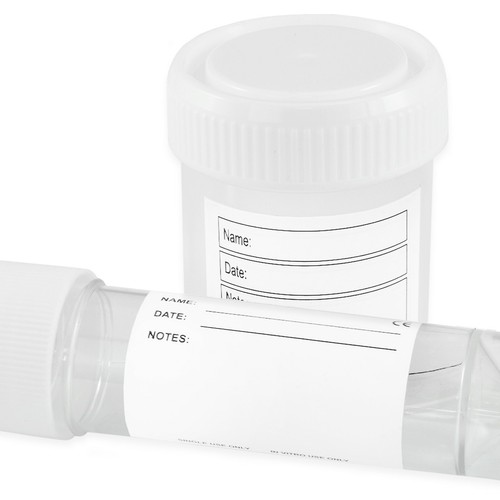 SMALL/LARGE SPECIMEN CONTAINER Urine Sample Medical Lab Test Tube Tub ...