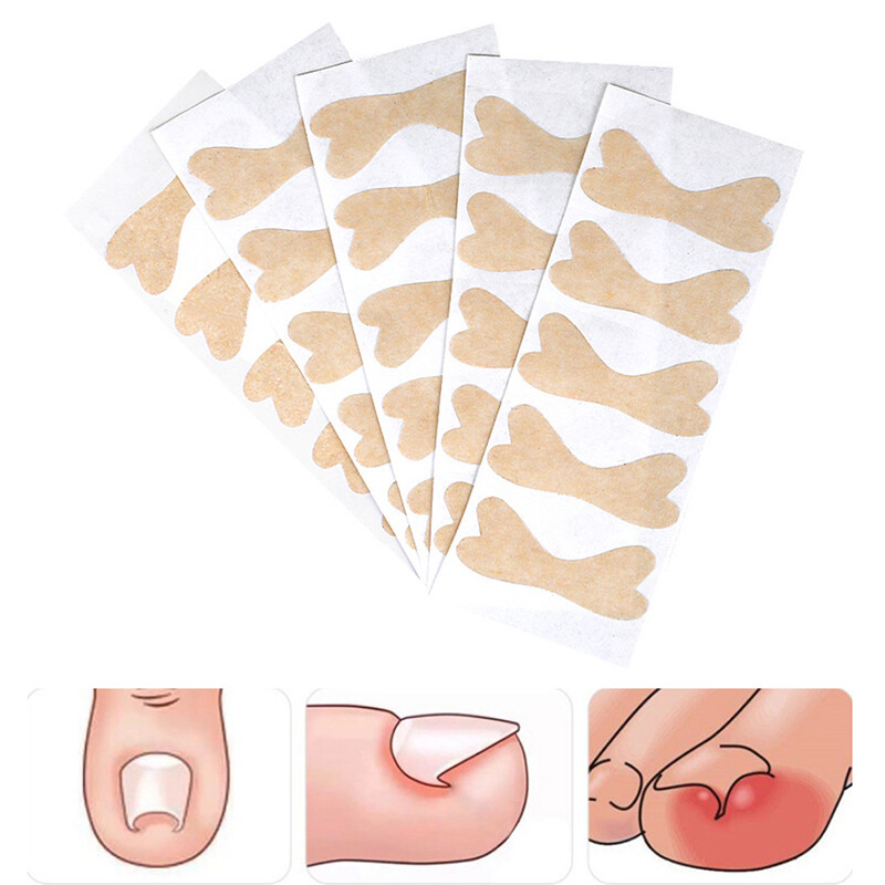 1sheet Ingrown Toe Foot Nail Correction Sticker Pedicure Toenail Correc ...