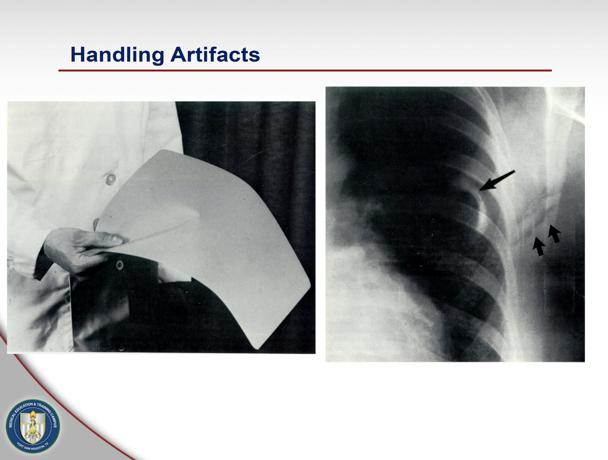 Radiography Pixel Density Radiographic Receptors