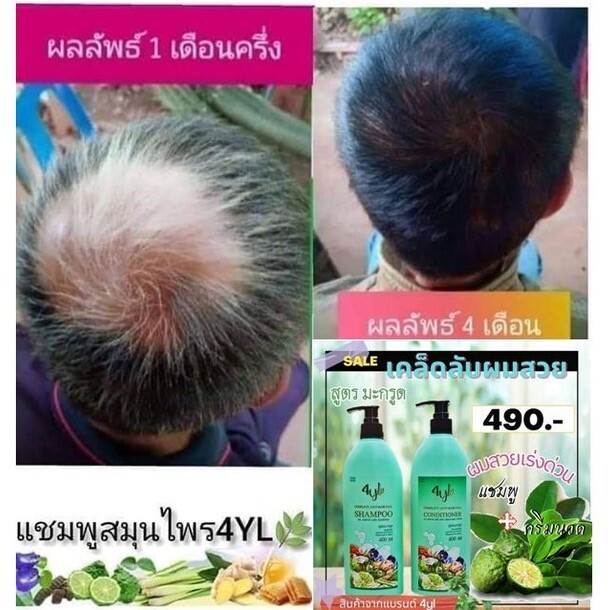 Set 4YL Thai Herbal Bergamot Shampoo 400 ml + Hair Conditioner 400ml | eBay