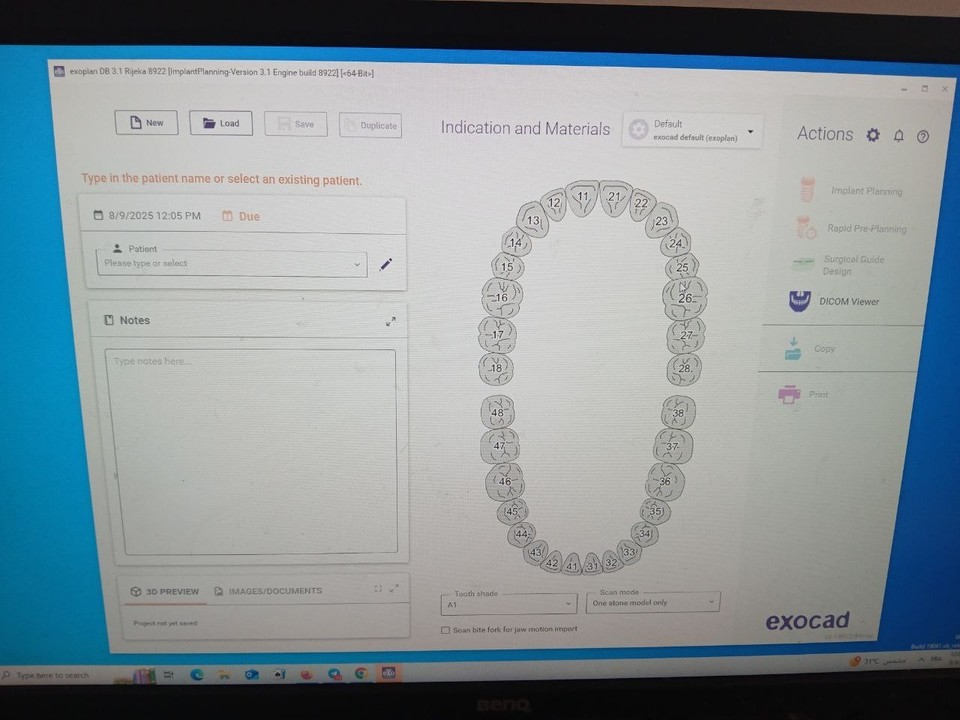 EXOCAD 3.2 ELEFSINA DONGLE | eBay UK