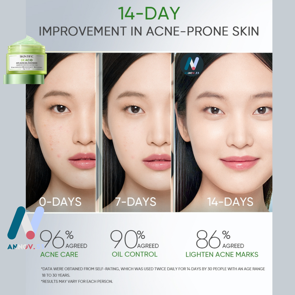 SKINTIFIC 3X Acid Anti Acne Gel Moist Calm Soothe Redness Sebum Clogged ...