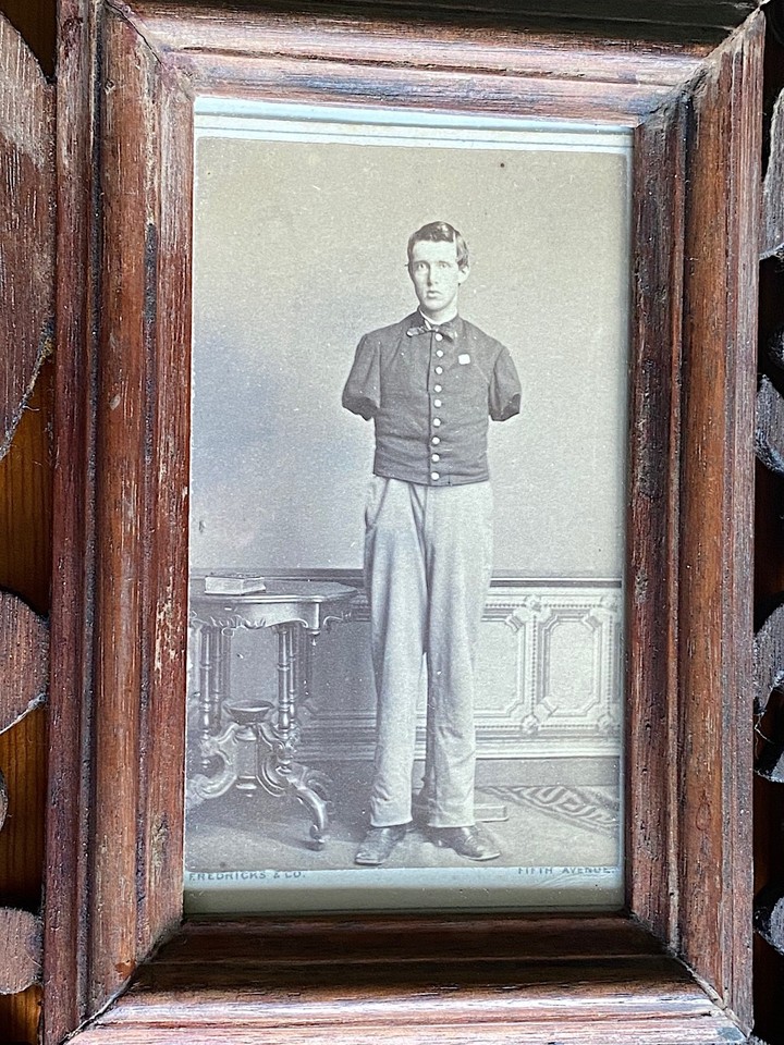 Civil War Double Amputee Private Alfred Stratton 147th NY CDVs in ...
