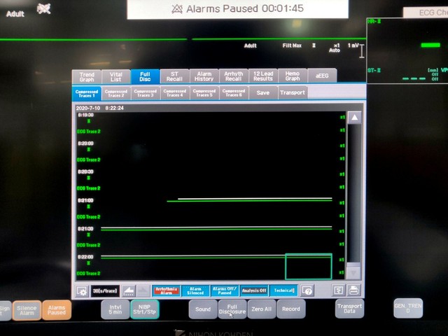 Nihon Kohden Life Scope G9 Bsm-1733 Bedside Patient Monitor Cu-192r ...