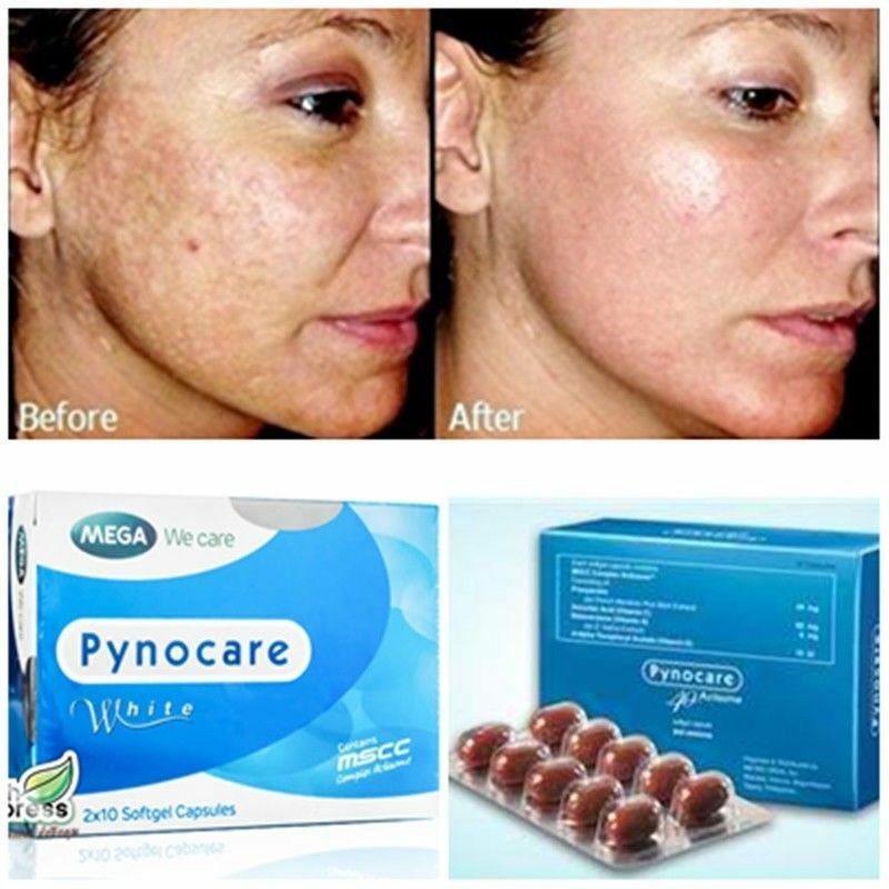 60 Capsules Pynocare Whitening Anti Melasma Hyperpigmentation Skin Care ...