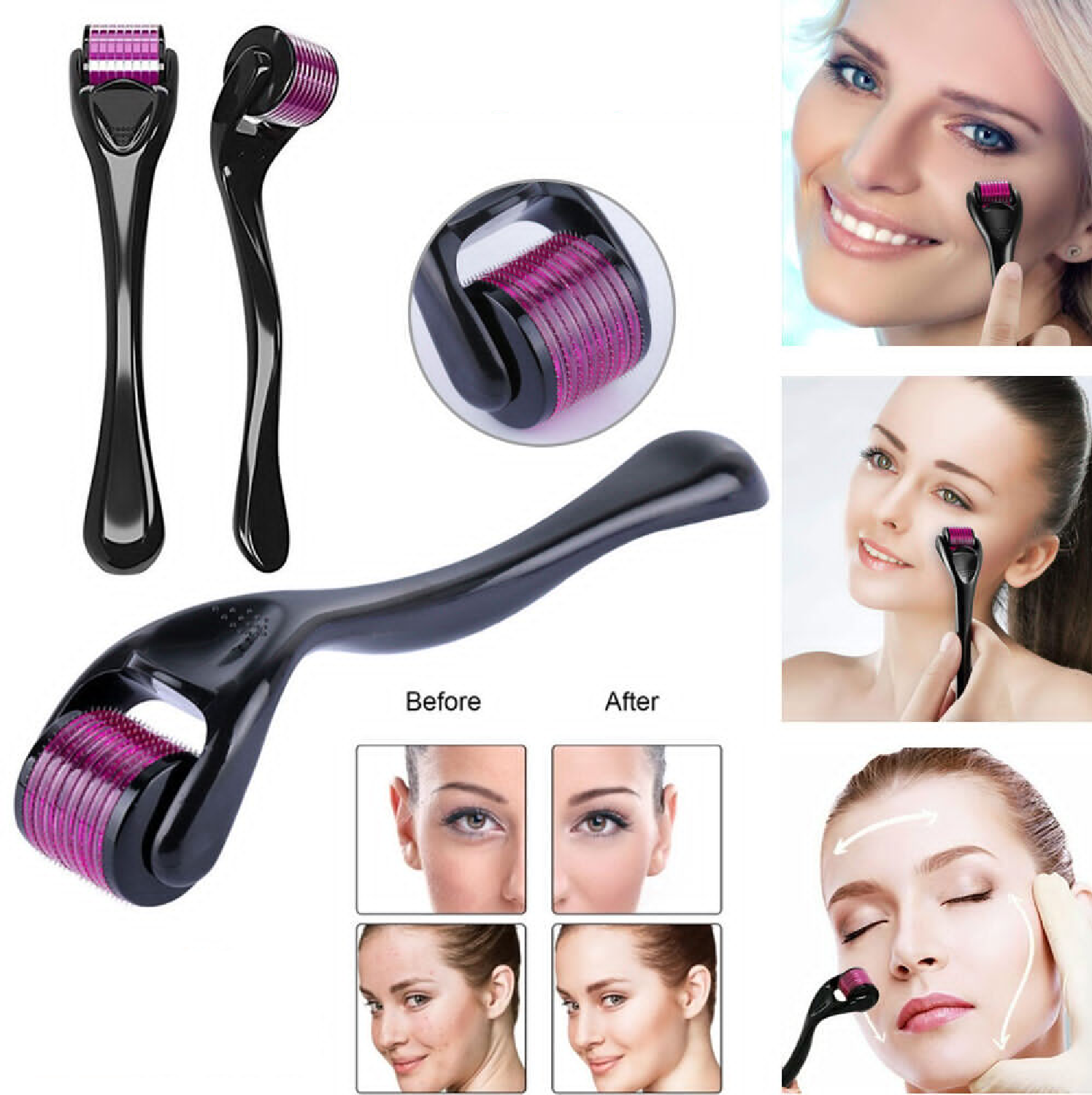 540 Needles Derma Roller Scars Titanium Micro Needle Anti Aging ...