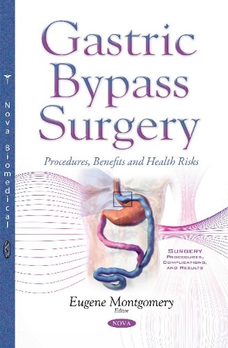 Eugene Montgomery Gastric Bypass Surgery (Paperback) (UK IMPORT ...