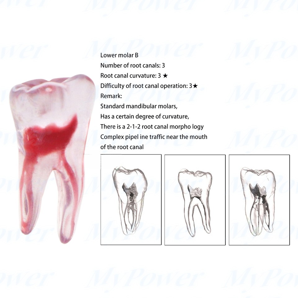 Dental Training 3D RCT Endo Tooth Model Practice Model Curved Root ...