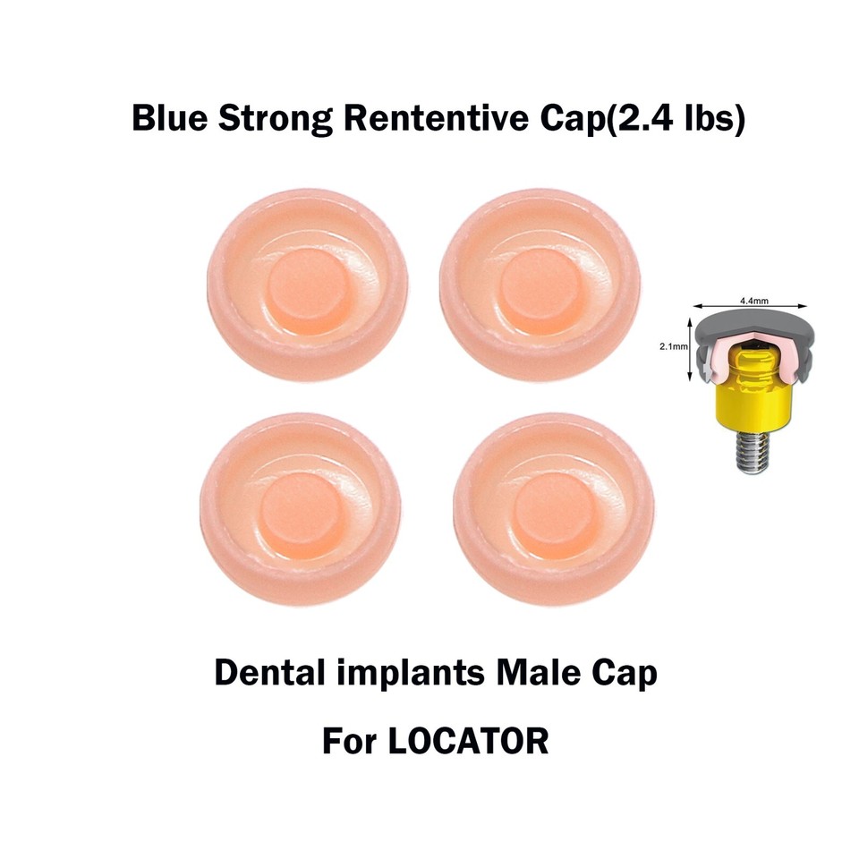 Dental Universal Implant Retention Locator Caps Replacement 1.2lbs 2 ...