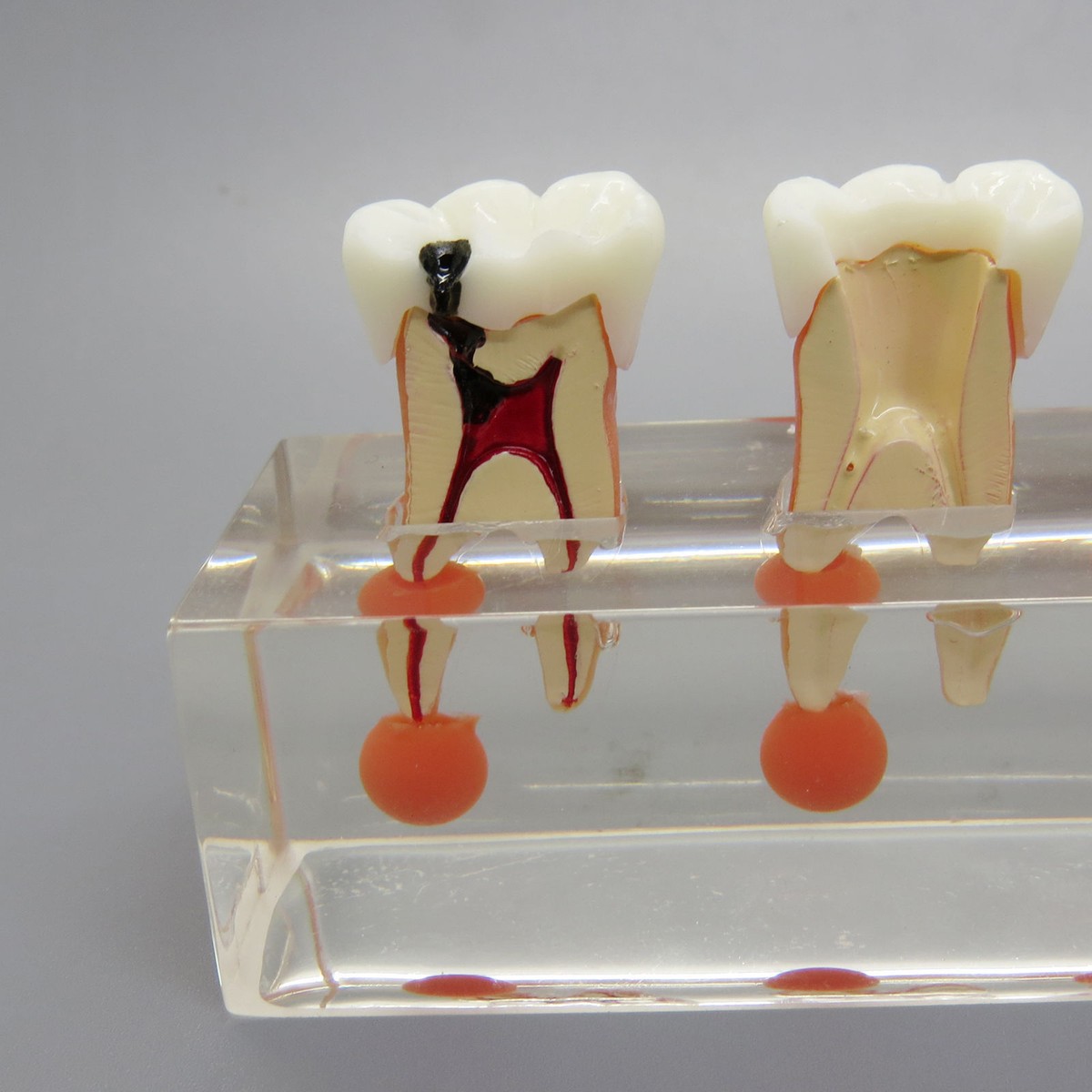 Tooth Model Dental Endodontic Treatment Model Anatomy Of Gums Mandible ...
