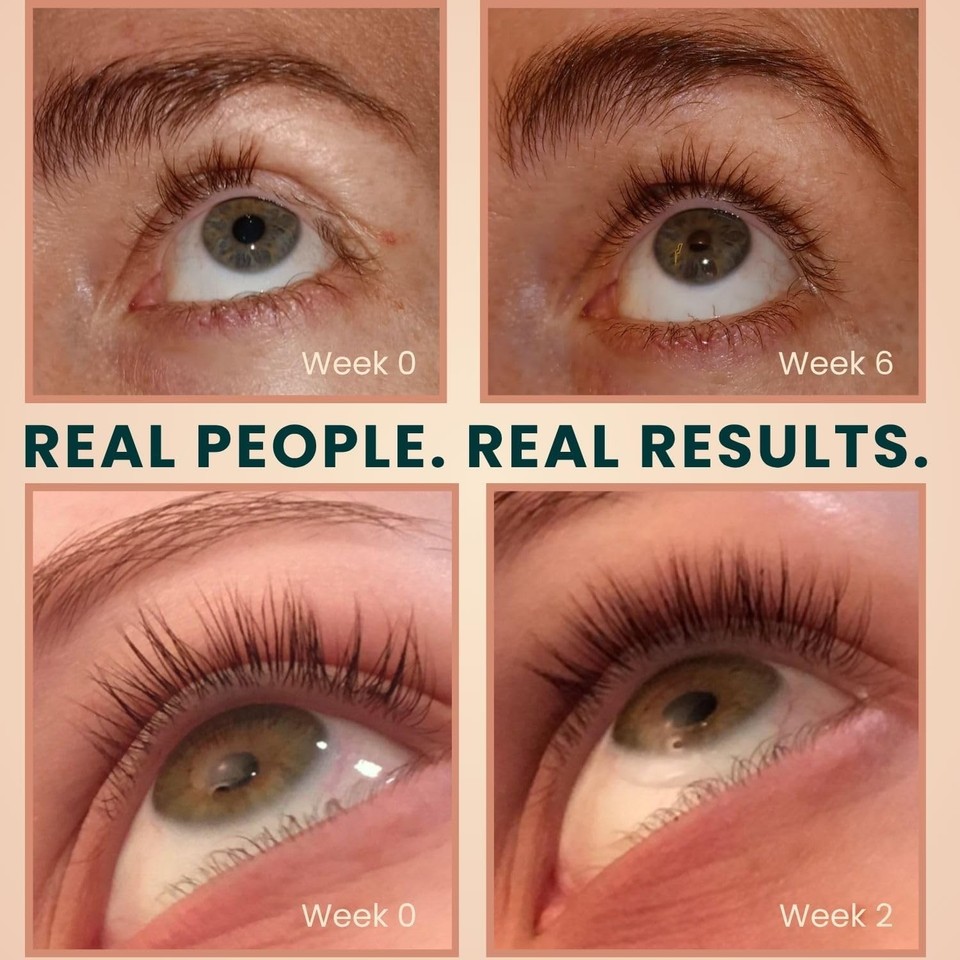 Live Fraiche Organic Castor Oil Lash Serum for 2 Fl Oz (Pack of 1 ...