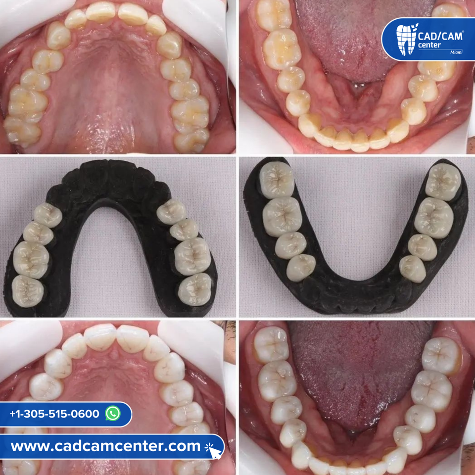 DENTSPLY SIRONA CEREC PrimeScan + PrimeMill + Suction unit + SpeedFire ...