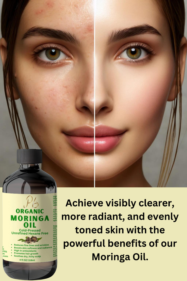 Organic Cold-Pressed Moringa Oil for Skin, Hair & Body - Anti-Aging ...