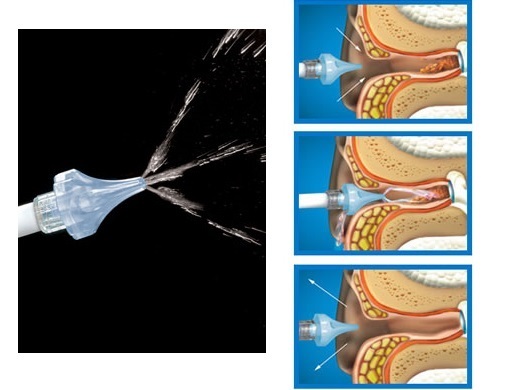 OtoClear Ear Wax Removal Clean Canal 6 Months and Up Water Dispersed ...