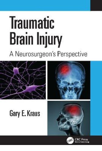 Traumatic Brain Injury: A Neurosurgeon's Perspective by Kraus, Gary ...