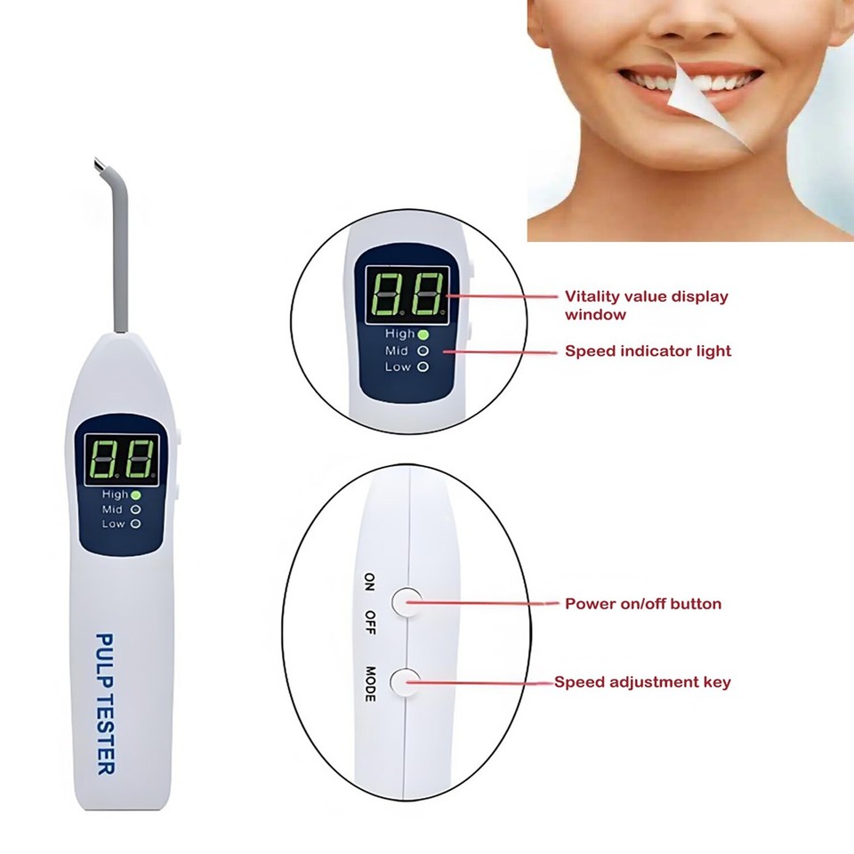 Dental-Oral Electric Pulp Tester~Teeth Nerve Testing Vitality Endo ...