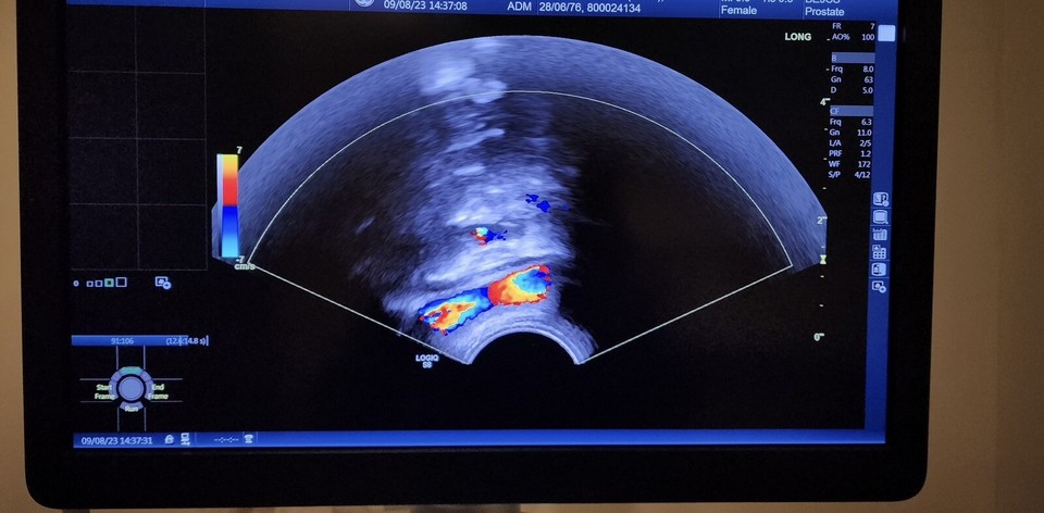 Ge ultrasound probe BE9CS-D | eBay