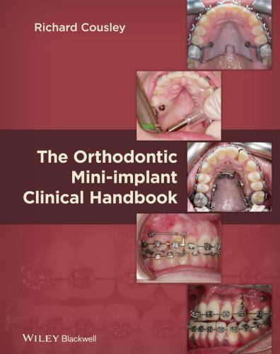 The Orthodontic Mini-implant Clinical Handbook, Cousley, Richard, New ...