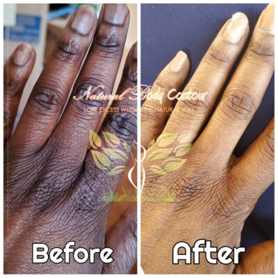 Dark knuckles cream, Skin lightening, Dark hands, Natural lightening | eBay