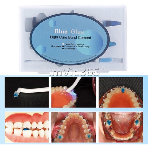 Fresh Dental Orthodontic Adhesive Light Cure Band Cement Blue Glue ...