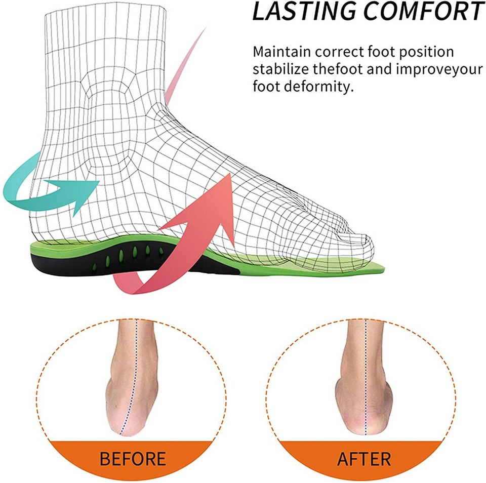 Orthotic Arch Pad Flat Foot Special Correction Insole Men & Women Arch ...