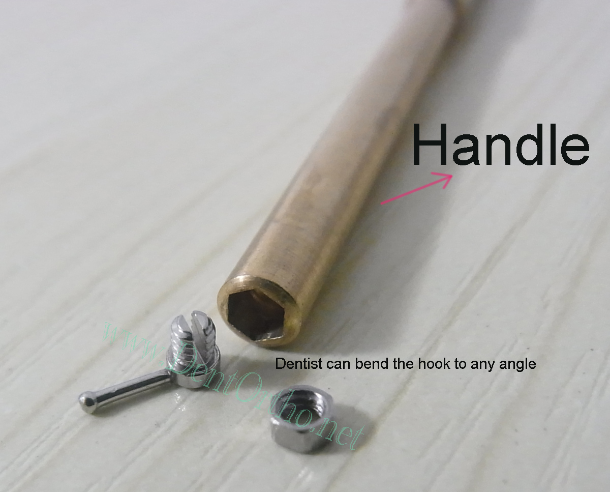 10pc Grip Gurin lock Grip lock archwire stop dental orthodontics molar ...